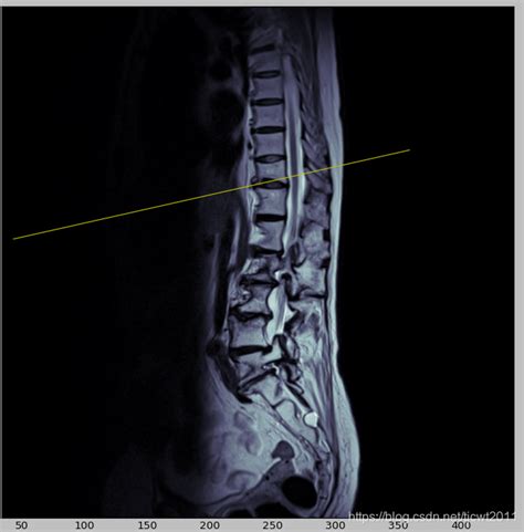 Python中matplotlib库显示界面中进行鼠标交互绘制操作matplotlib 画面鼠标操作 Csdn博客