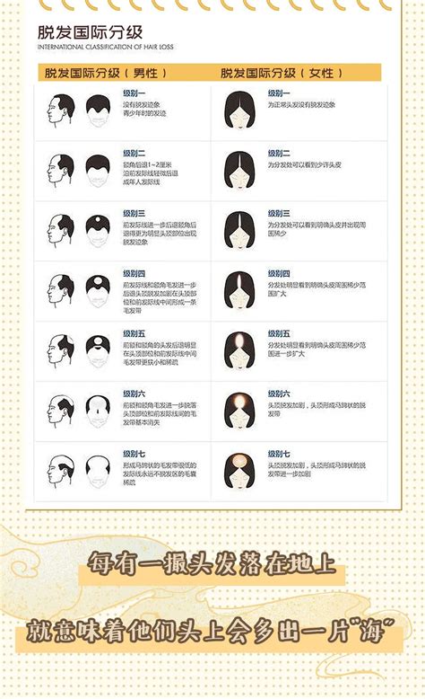 2022脱发等级对照表 科普 健康160资讯网