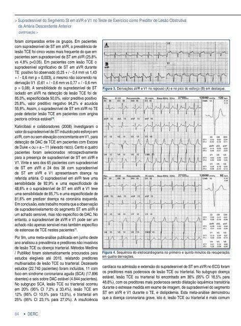 Figura 2 Eletrocardiogra