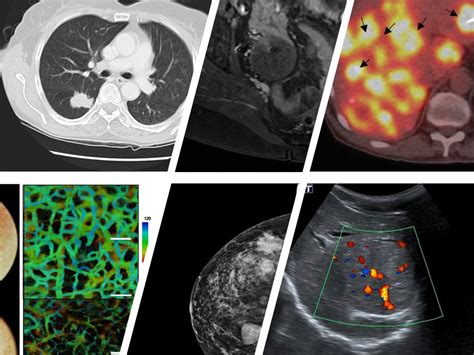 The Cancer Imaging Program Cip Nci