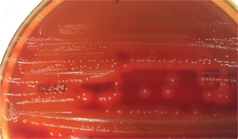 Biochemical Test Of Streptococcus Canis