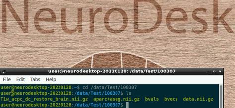 Structural Connectivity Dmri Neurodesk Structural Connectivity Dmri Neurodesk