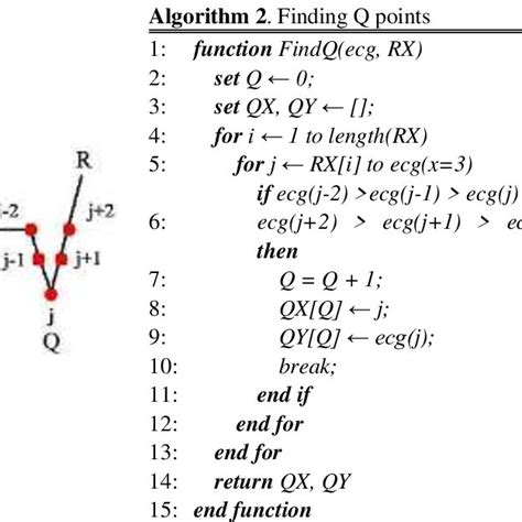 Detection Of Q Points Download Scientific Diagram
