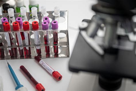 Pemeriksaan Hemoglobin Metode Sahli Informasi Seputar Gizi