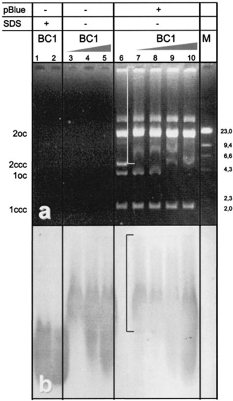 Comparison Of The Migration Behaviors Of Plasmid Dna Pbluescript