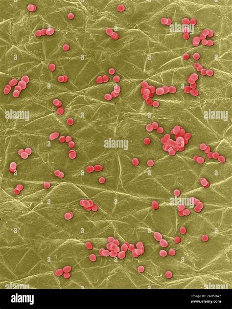 Coloured Scanning Electron Micrograph Sem Of Photocomposite Enterococcus Faecium On The