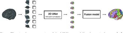 Fully Automated Tumor Segmentation For Brain Mri Data Using Multiplanner Unet