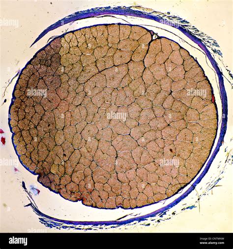 Cross Section Of Nerve