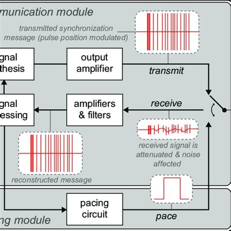 Electrocardiograms Ecgs Recorded During Leadless Cardiac