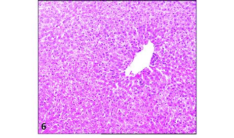 Representative Histological Sections Of The Liver 200 Â Magnification