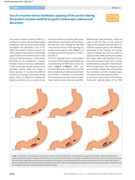 Pdf Use Of A Traction Device Facilitates Opening Of The Pocket During The Pocket Creation
