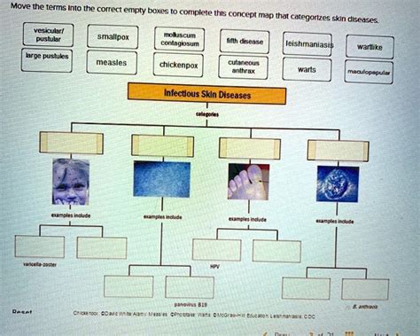 Move The Terms Into The Correct Empty Boxes To Complete This Concept Map That Categorizes Skin