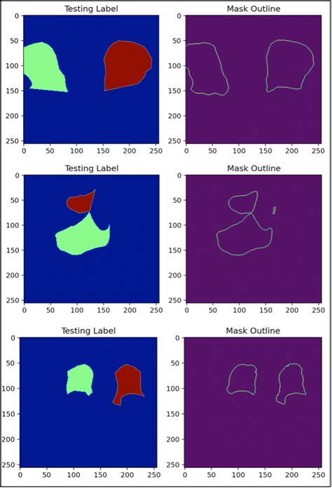 A 2d And 3d Foot Image Segmentation Framework For An Ar Based Shoe Try