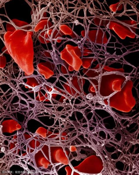 血管损伤【多图】39医疗图集 39健康网