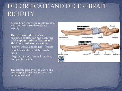 Muscle Tone And Deep Tendon Reflex Assessment Pptx