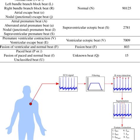 Pdf Arrhythmia Classification From Single Lead Ecg Signals Using The Inter Patient Paradigm