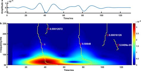 Start Algorithm For Estimating A2‐p2 Splitting Interval A A Download Scientific Diagram