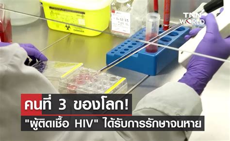 ผู้ติดเชื้อ Hiv ได้รับการรักษาจนหายเป็นคนที่ 3 ของโลก ด้วยวิธีนี้