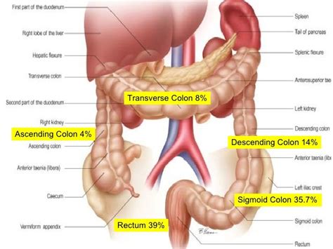 Ascending Colon Definition Location Function Problems Cancer And