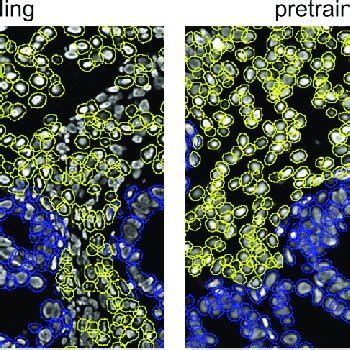 Nuclei Segmentation Options Nuclear Segmentation Based On Manual Download Scientific Diagram
