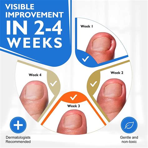 Ingrown Toenail Treatment Kit 30ml Professional Drops With Shea