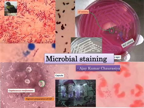 Bacterial Staining Methods Pptx