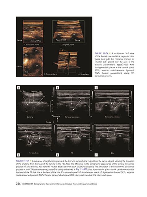 알라딘 미리보기 통증의학을 위한 근골격계 초음파 해부학