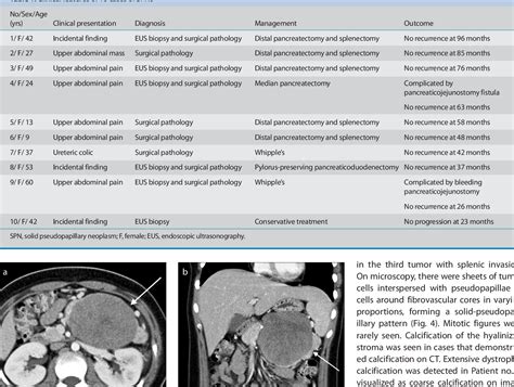 Table 1 From Solid Pseudopapillary Neoplasm Of The Pancreas Ct Imaging Features And Radiologic