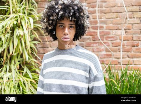 A Mixed Race Woman With Vitiligo Wearing A Striped Sweater Poses By A