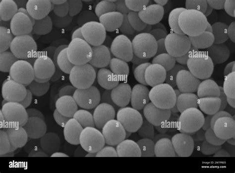 Methicillin Resistant Staphylococcus Aureus Mrsa Under Scanning