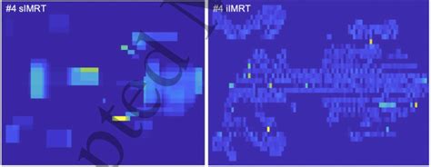 The Fluence Maps Of Simrt And Iimrt For One Of The Tmi Fields Download Scientific Diagram