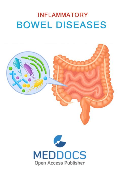 Inflammatory Bowel Disease