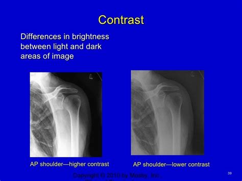 Clo 5 Critique The Radiographic Contrast Within Various Radiographic