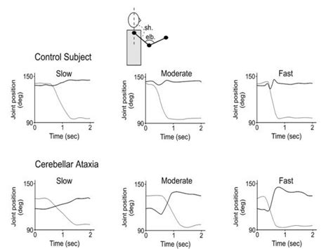 Effects Of Increasing Velocities On Kinematics Of The Upper Limb Download Scientific Diagram