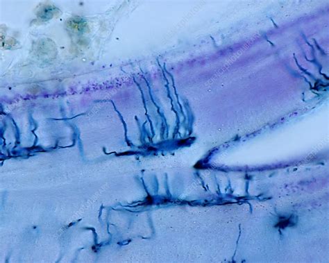 Osteocytes Light Micrograph Stock Image C0528851 Science Photo