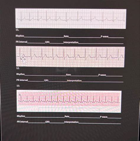 Rhythm Rate P Wave PR Interval QRS Chegg Com