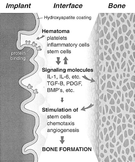Schematic Drawing Of The Bone Implant Interface The Processes And