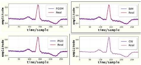 Ecg Atk Gan Robustness Against Adversarial Attacks On Ecg Using Conditional Generative
