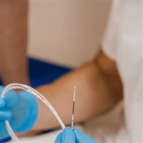 China Ultrasound Guided Peripheral Nerve Block Needle Stainless Steel 22g Ultrasound Suppliers