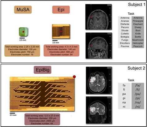 Color online µECoG arrays layout and position over the cortex of Download Scientific Diagram