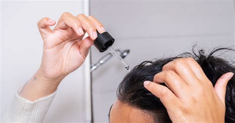 How To Determine Your Scalp Type According To A Dermatologist