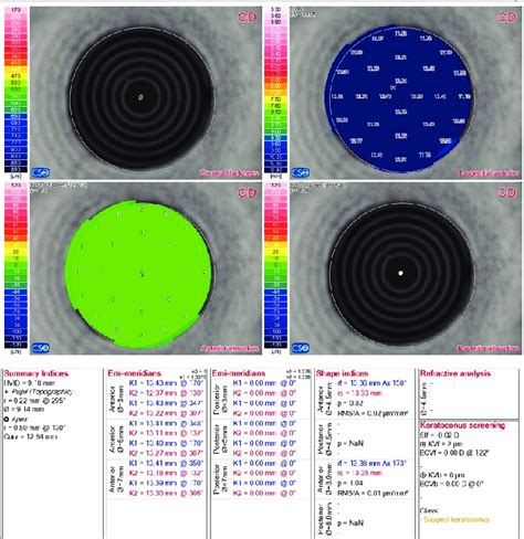 Keratometry Values Of Case Number Download Scientific Diagram