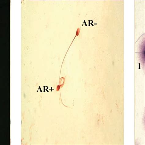 Acridine Orange Acrosome Reaction And Sperm Chromatin Dispersion Test