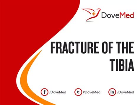 How Well Do You Know Fracture Of The Tibia Dovemed
