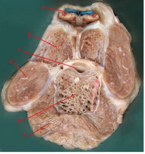 Diagram Of Transverse Section Through Root Of Male Genitalia Quizlet