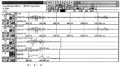 Analysis Of Acoustic Prosodic Features Of Responses Two Examples Download Scientific Diagram