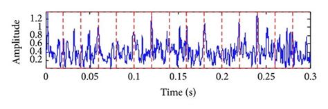 Analyzed Results Of The Simulated Signal With Double Resonance Bands Download Scientific