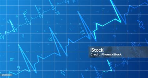 Ekg Ecg Cardiogram Moving Healthcare Medical Bg Health Innovation Concept With Hexagons