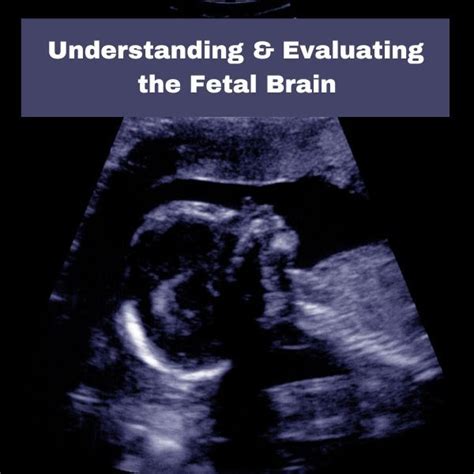 Understanding Evaluating The Fetal Brain Artofit