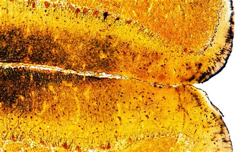 Brain Tissue Light Micrograph Stock Image C001 0801 Science Photo Library